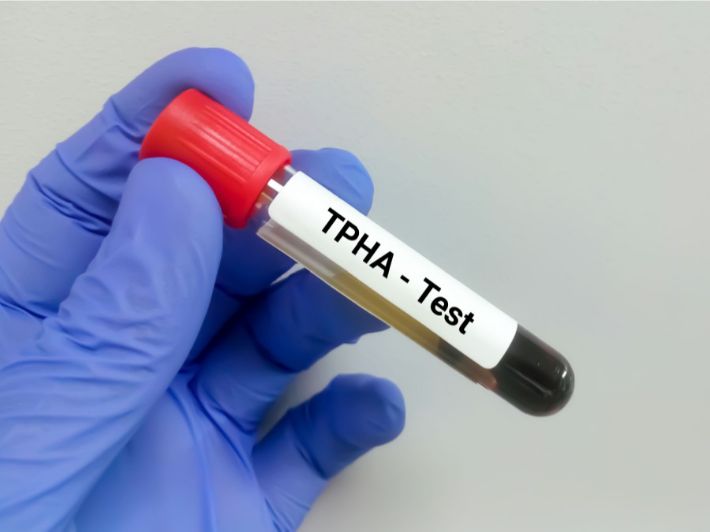 ما هو تحليل TPHA